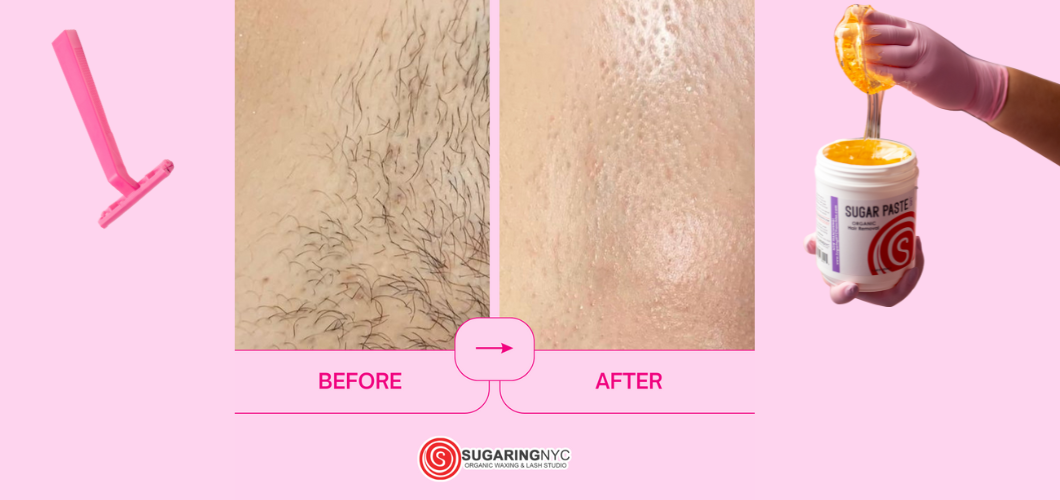 Sugaring vs. Shaving: What You Should Know